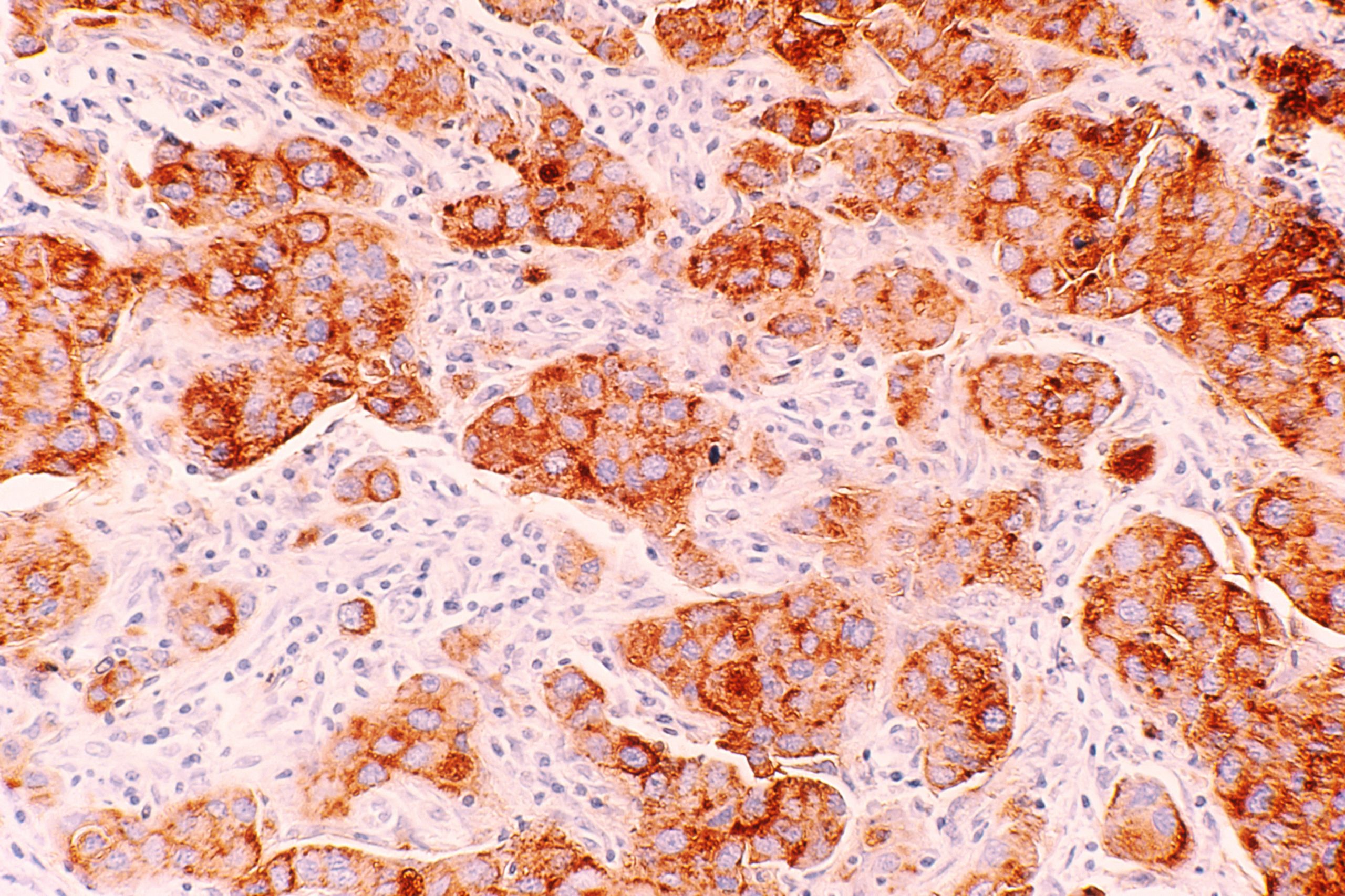 Obesity: a new tool to diagnose visceral fat by Research Luxembourg ...
